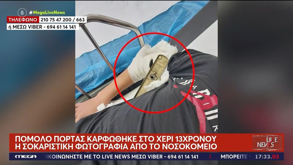 Βόλος: Πώς έγινε το ατύχημα με το πόμολο που καρφώθηκε στο χέρι μαθητή ...