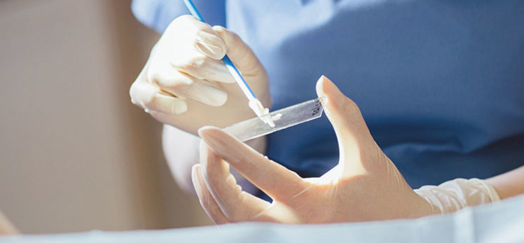 Δωρεάν τεστ ΠΑΠ στο Μακρυχώρι του Δήμου Τεμπών – ONLARISSA.GR Νέα ...